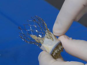 The Splitter - HVT Medical | The Splitter