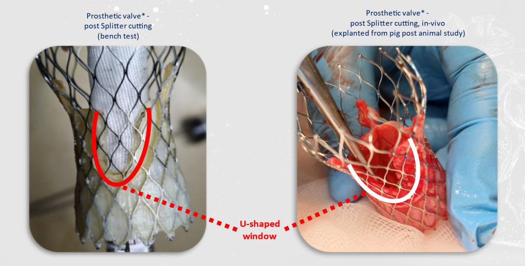 The Splitter - HVT Medical | The Splitter
